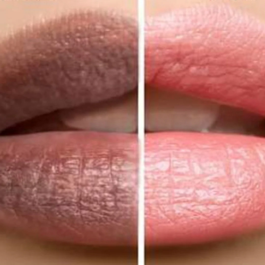 Buy Avienne Lips Therapy | Healthy Pink Lips, Collagen & Green Apple ...